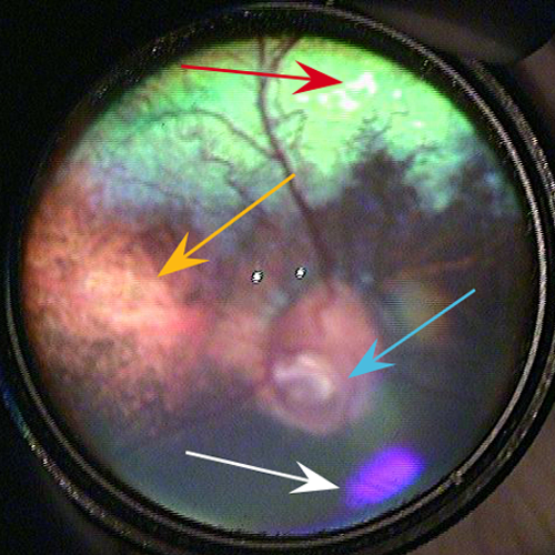 Image Gallery: Canine Fundus Diseases | Clinician's Brief