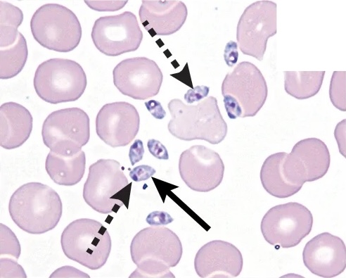 Clinical Image: Canine Blood Smear