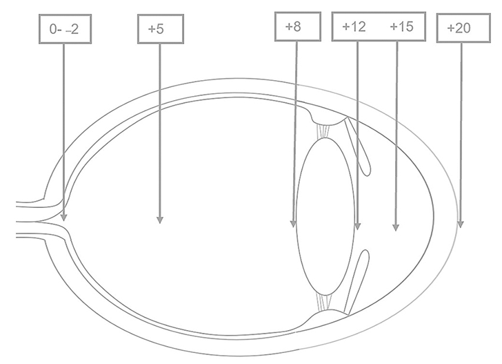 Fundic Examination | Clinician's Brief