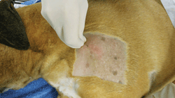 How to Collect Bone Marrow Samples | Clinician's Brief