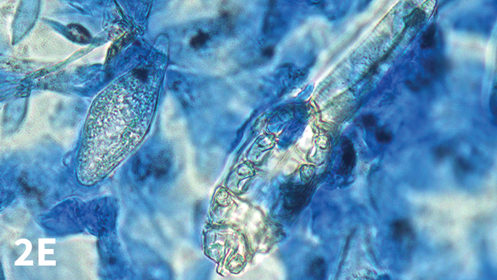 Skin Scraping for External Parasites | Clinician's Brief