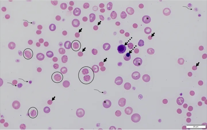 Clinical Image: Feline Blood Smear