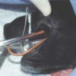 How To Place An Esophagostomy Tube | Clinician's Brief