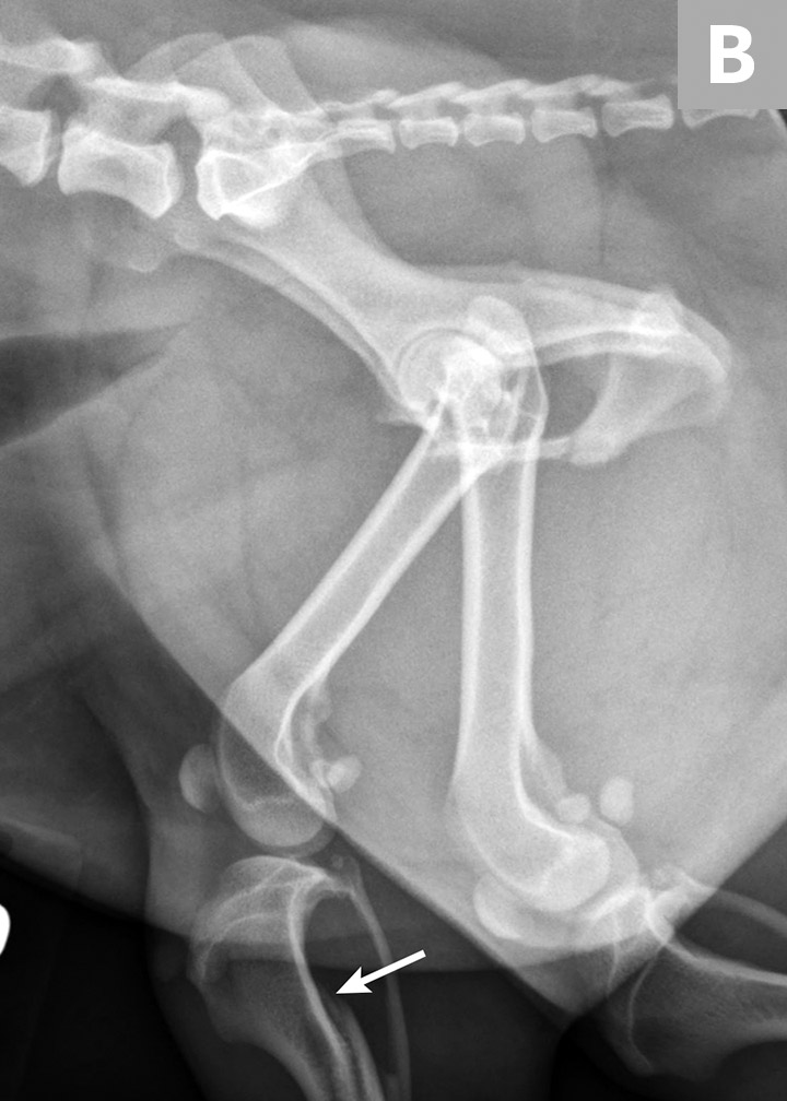 Pelvic Fractures | Clinician's Brief