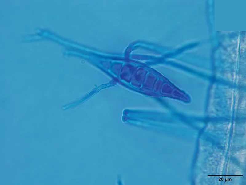 Clinical Image: Spindle-Shaped Macroconidia