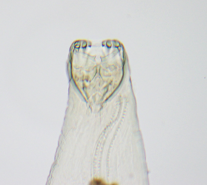 Persistent or Suspected-Resistant Hookworm Infections | Clinician's Brief