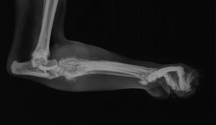Lameness & Osteomyelitis in a Cat | Clinician's Brief