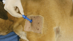 How to Collect Bone Marrow Samples | Clinician's Brief