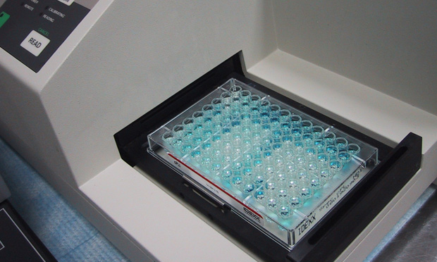 New Tests for Pancreatitis