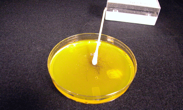 Fungal Cultures for Diagnosing Dermatophytosis: Guide