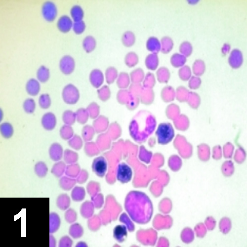 Feline Erythroparasites | Clinician's Brief