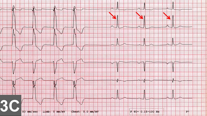 Top 5 Arrhythmias in Dogs & Cats | Clinician's Brief