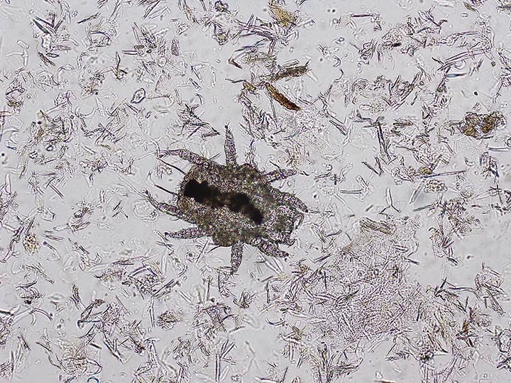 Clinical Image: Adult Mite
