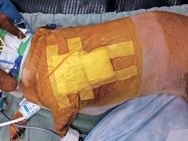 Flail Chest: Diagnosis & Bandaging | Clinician's Brief