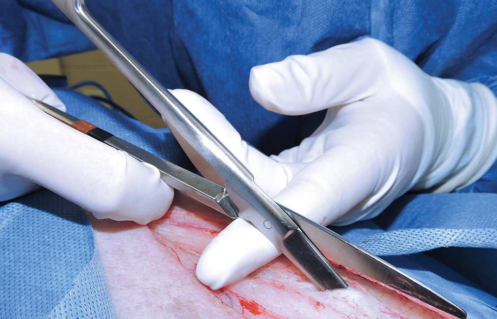 Identifying the Linea Alba & Avoiding Paramedian Incisions During ...