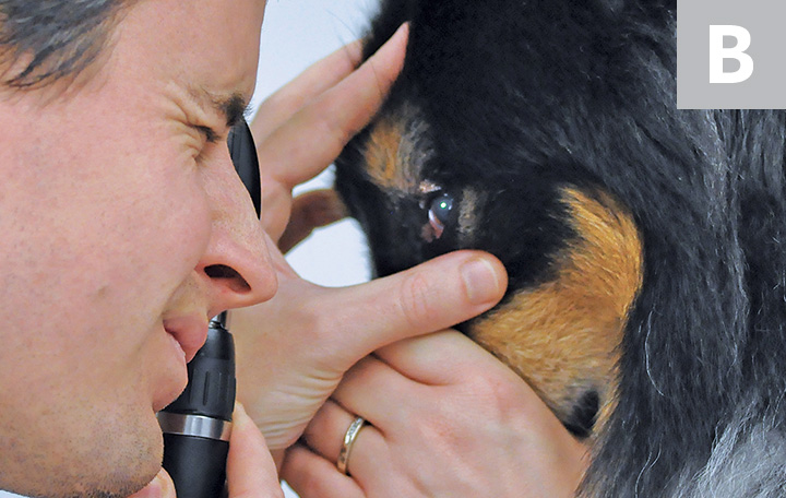 Fundic Examination | Clinician's Brief