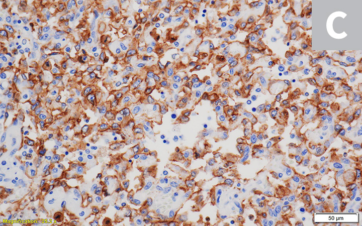 Canine Hemangiosarcoma | Clinician's Brief