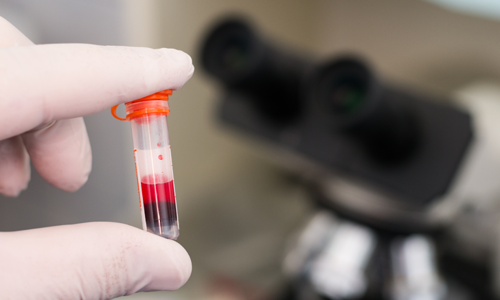 Top 5 Blood Collection & Sampling Errors | Clinician's Brief