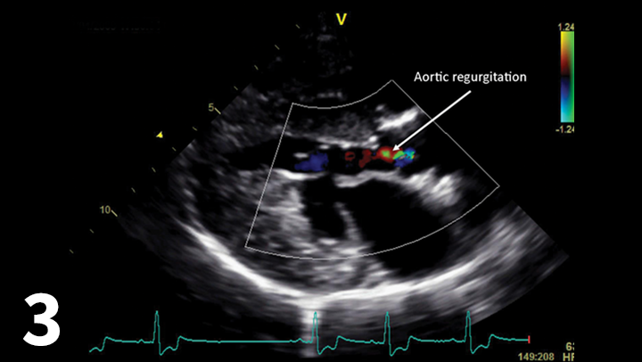 Cardiac Interventional Therapy in Companion Animals | Clinician's Brief