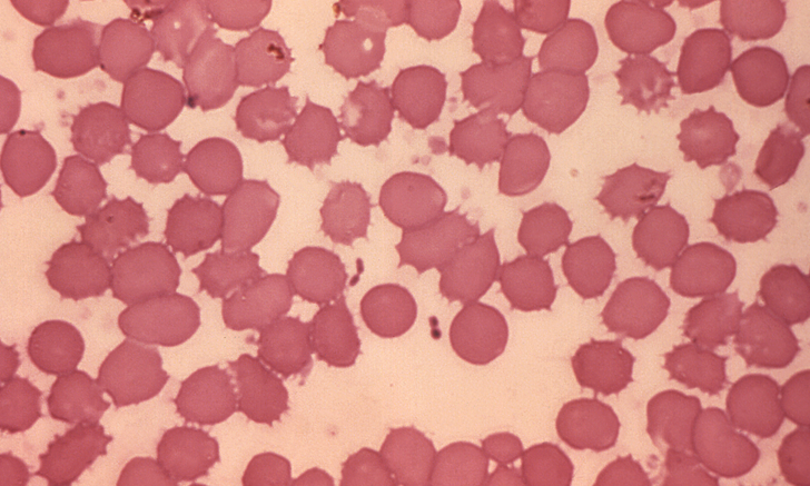 Plague in Cats & Dogs: A Public Health Concern