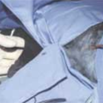 How To Place An Esophagostomy Tube | Clinician's Brief