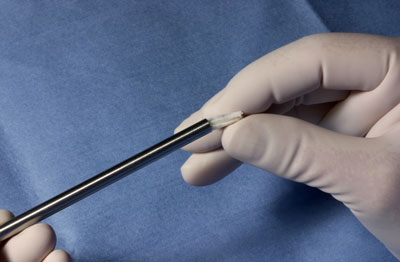 Laparoscopic Liver Biopsy | Clinician's Brief