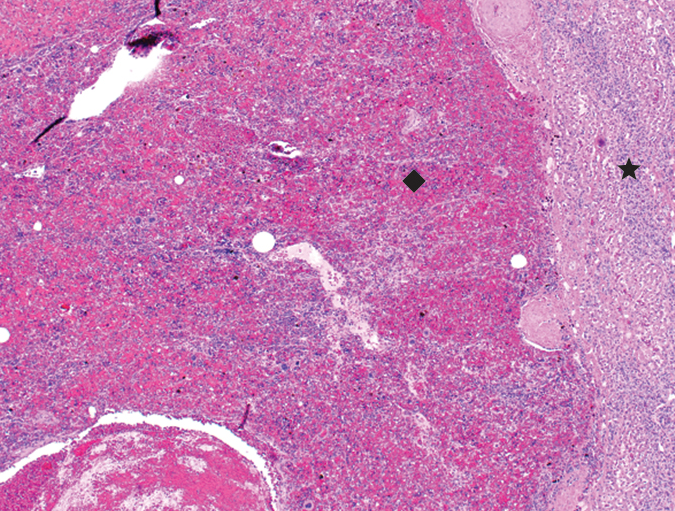 Intrahepatic Splenosis in a Labrador Retriever | Clinician's Brief