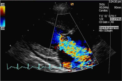 Chronic Valvular Disease in the Dog | Clinician's Brief