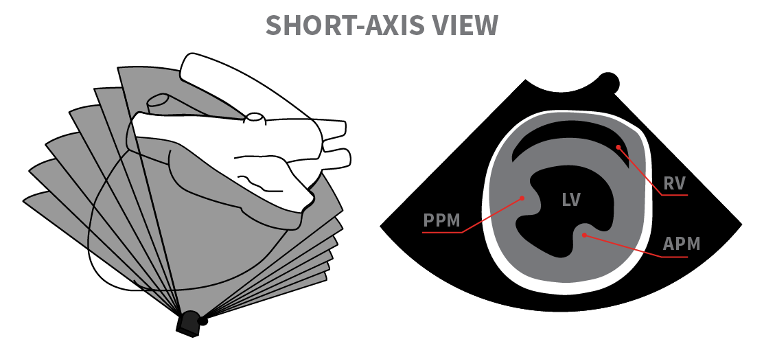Echocardiography in General Practice: 4 Views to Master | Clinician's Brief