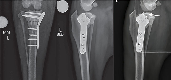 Common Tibial Plateau-Leveling Osteotomy Complications | Clinician's Brief