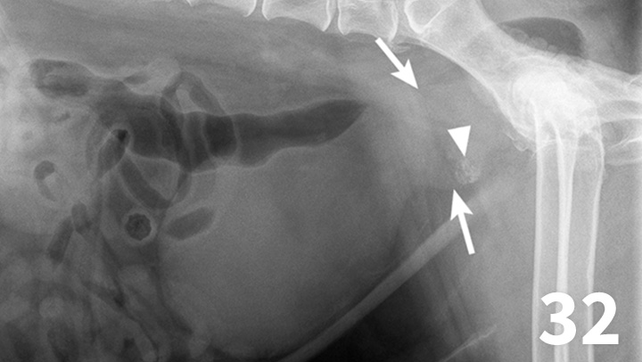 Imaging the Urinary Tract | Clinician's Brief