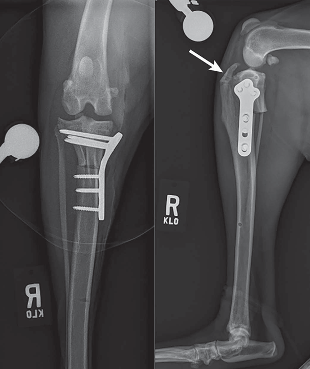 Common Tibial Plateau-Leveling Osteotomy Complications | Clinician's Brief