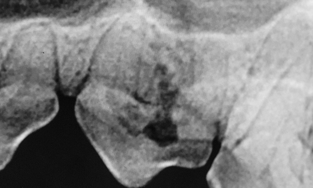 Treating Tooth Resorption in Dogs