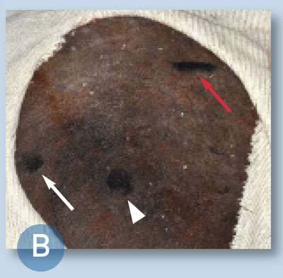 Femoral Head & Neck Ostectomy | Clinician's Brief