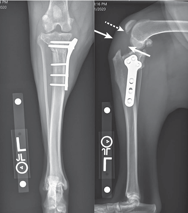 Common Tibial Plateau-Leveling Osteotomy Complications | Clinician's Brief