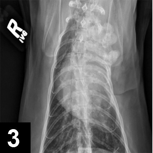 Horner Syndrome at a Glance | Clinician's Brief