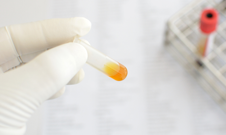 Causes of Icterus (Jaundice) in Dogs | [site:name]