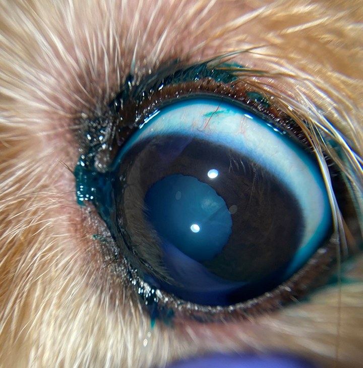 Lissamine Green Staining for Tear Film Deficiency Evaluation ...