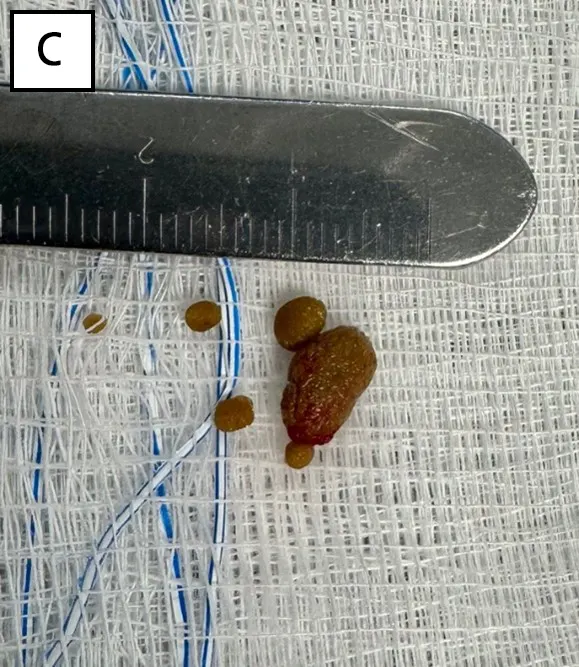 Cystotomy in Dogs & Cats: Step-by-Step Guide for Vets