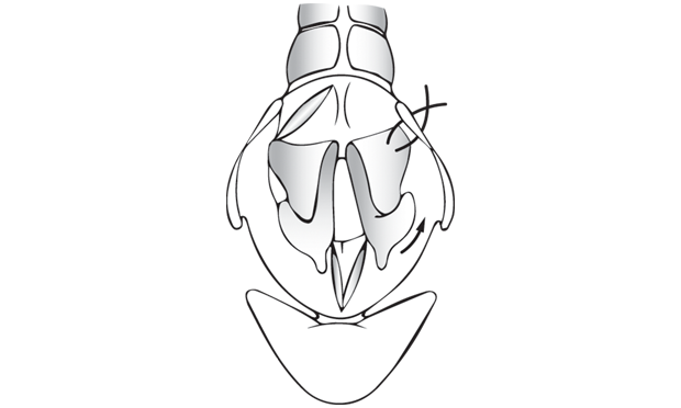 Laryngeal Paralysis: Guide for Cricoarytenoid Lateralization
