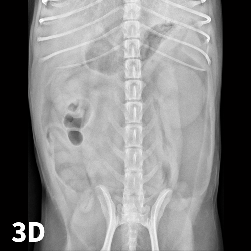 Top 5 Tips on Radiographic Diagnosis of Obstructive Foreign Bodies