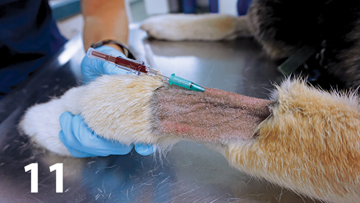 Step-by-Step: Peripheral Catheter Placement | Clinician's Brief