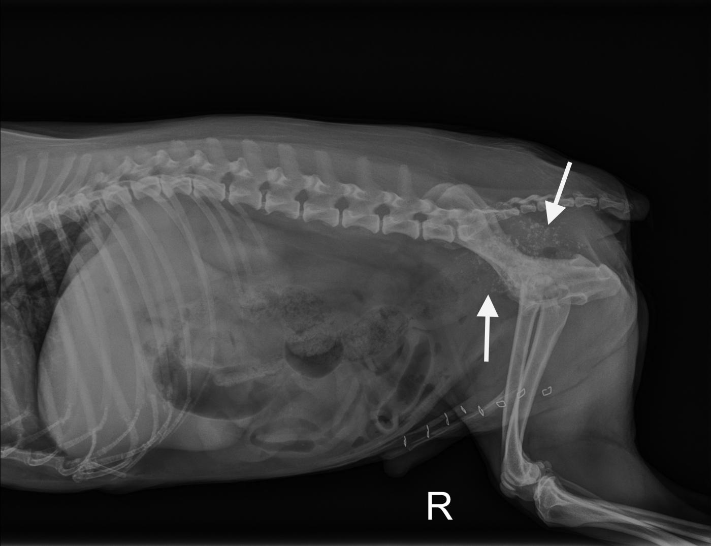 Enlarged Prostate X Ray