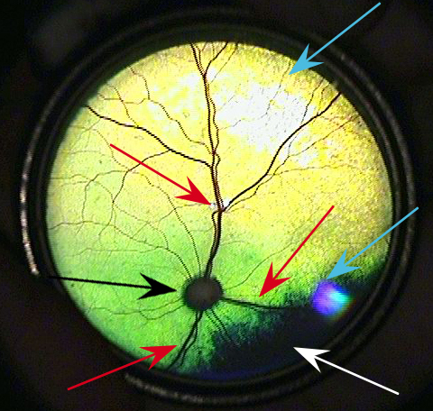 Image Gallery: Feline Fundus Diseases | Clinician's Brief