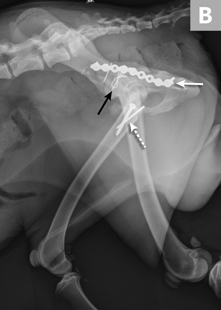 Pelvic Fractures | Clinician's Brief