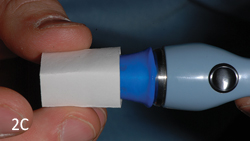 Determining Intraocular Pressure | Clinician's Brief