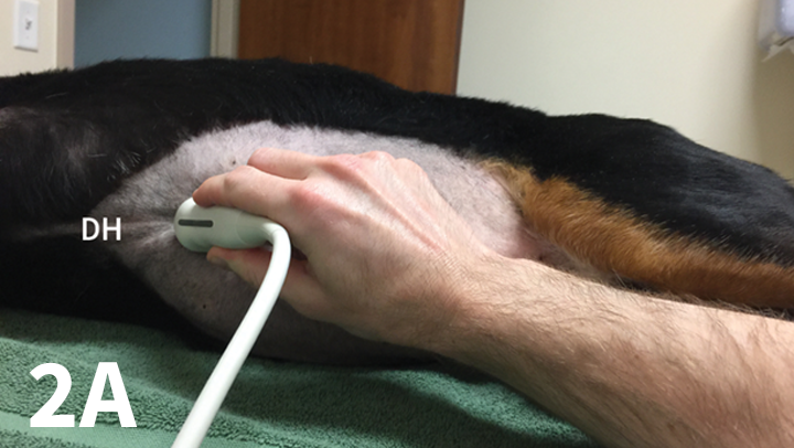 Abdominal Focused Assessment with Sonography for Trauma | Clinician's Brief