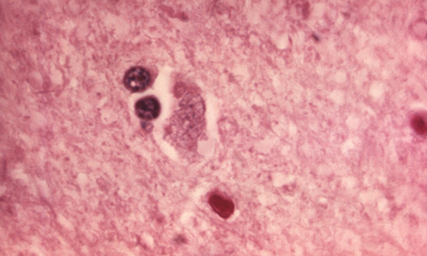 Handling Potential Rabies Exposure