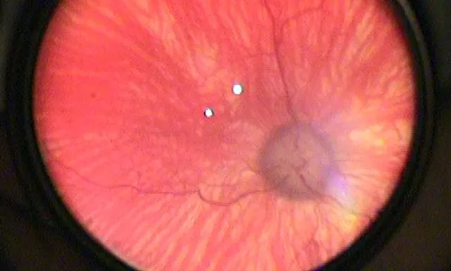 Image Gallery: Canine Fundus Diseases