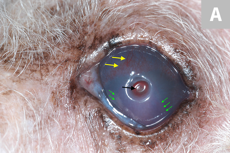 Corneal Perforation